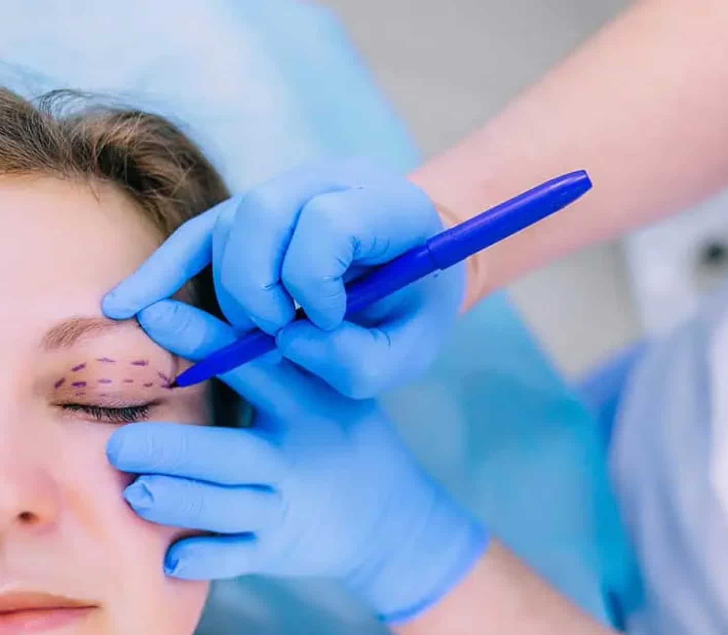 Oculoplastic & Eyelid Surgery Las Vegas | New Eyes Oculoplastic Surgery